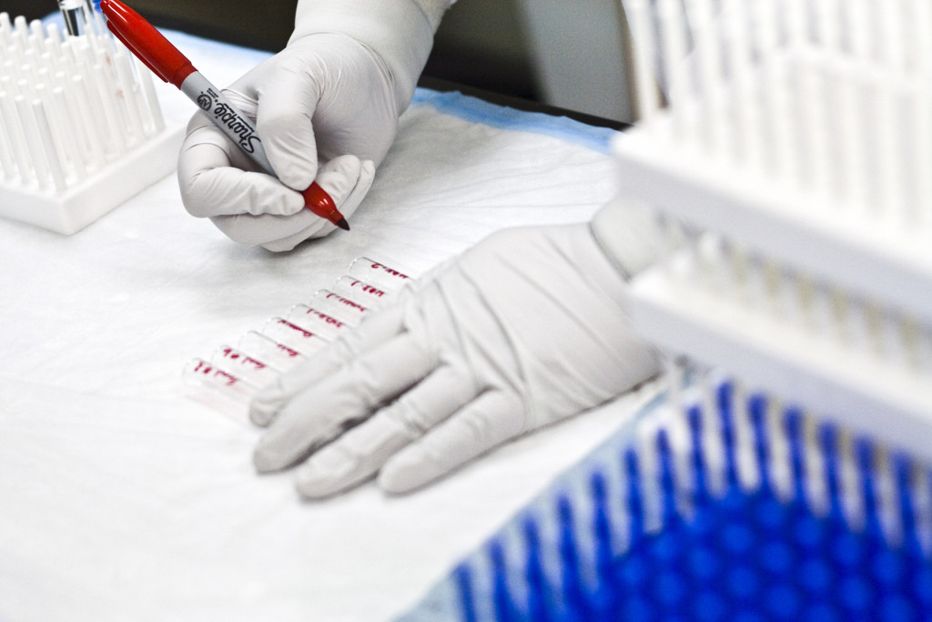 Biospecimen Procurement – Dx Biosamples