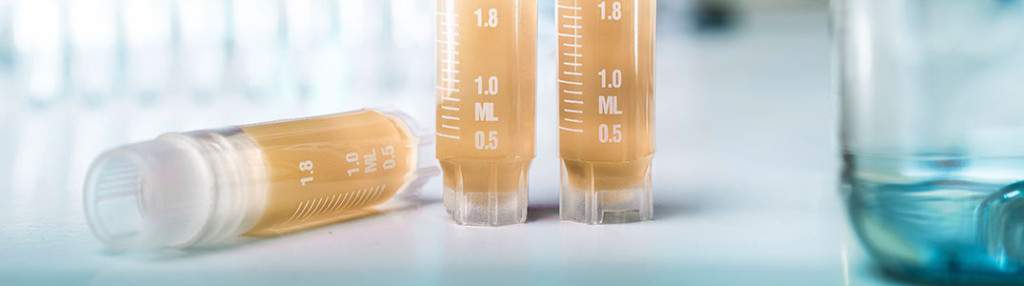 Biospecimen Procurement – Dx Biosamples